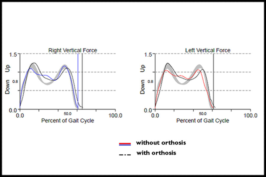 40 reasons | Allard AFO